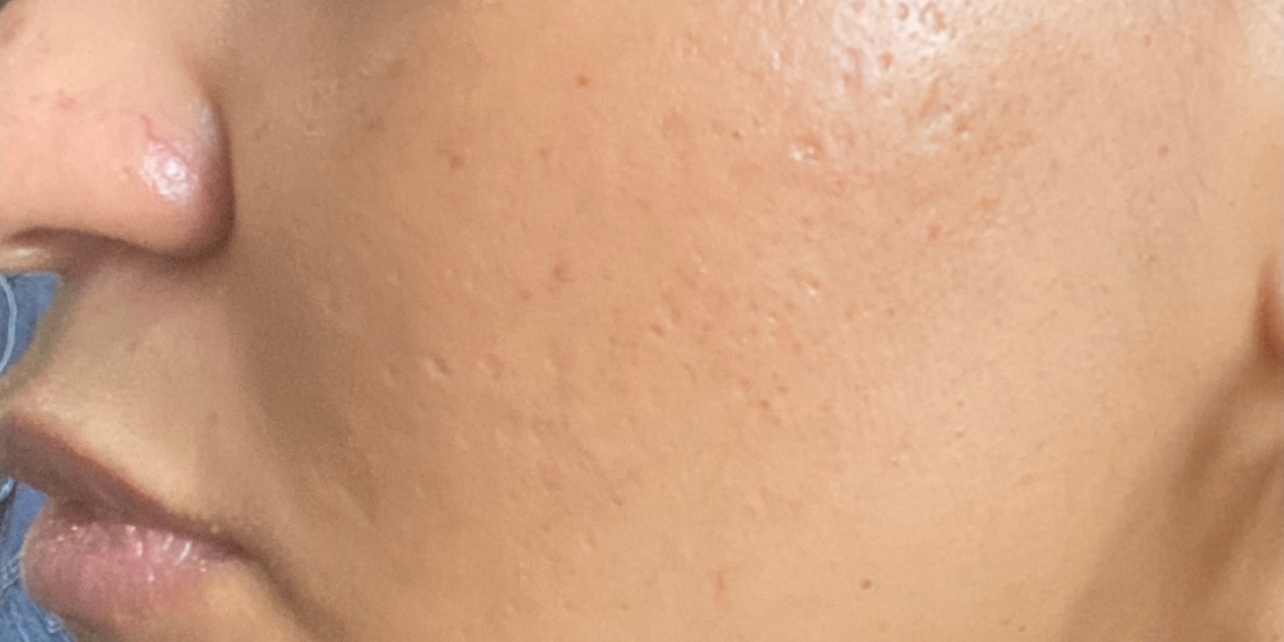 Shop Skincare Products Online – Yearn Skin