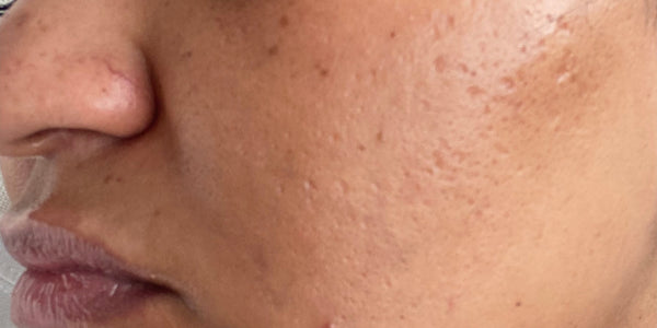 Shop Skincare Products Online – Yearn Skin